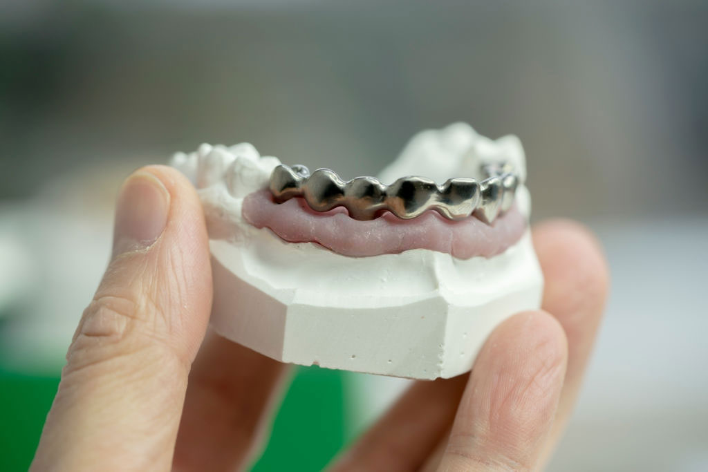 Comprehensive Guide to Tooth Restoration at Novacare Dental, Kothrud ...