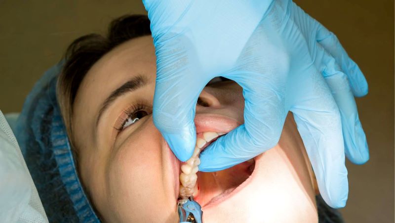 Wisdom Teeth Removal & Oral Health | Top Dentist In Pune